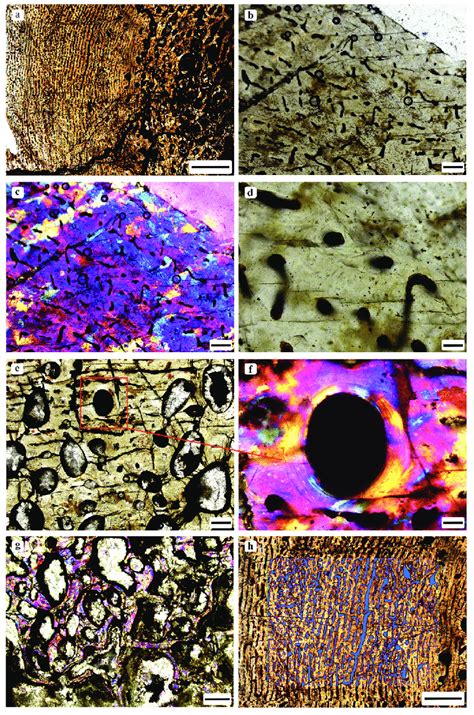 Bone Microstructure In The Humerus Of Clgpr V00007 A The Compact And Download Scientific