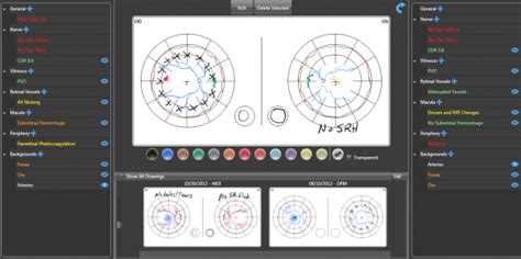 Best Optometry Emr Software Buyer S Guide 2022 Emrsystems