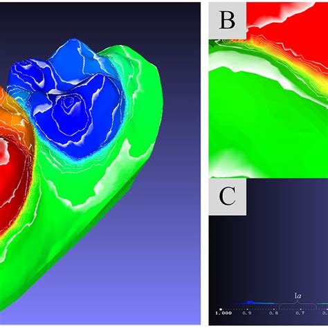 Pdf Interactive Tooth Separation From Dental Model Using Segmentation