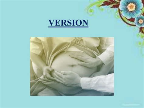 External Cephalic Version Obg Notes Pptx