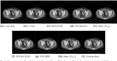 Figure 12 From Wavelet Subband Specific Learning For Low Dose Computed