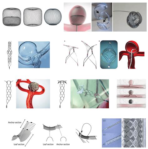 New Devices For Intracranial Aneurysm Treatment A D Woven