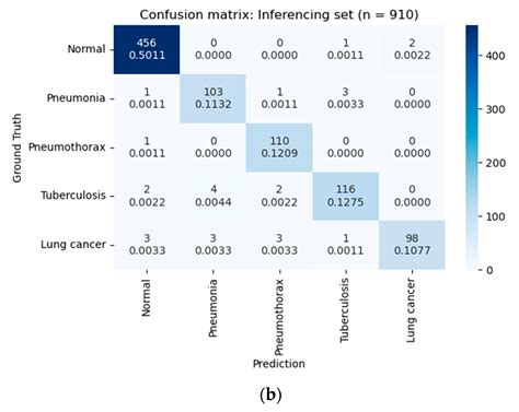 Oview Ai Supporter For Classifying Pneumonia Pneumothorax Tuberculosis Lung Cancer Chest X