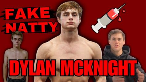 Exposing Dylan Mcknight Fake Natty Youtube