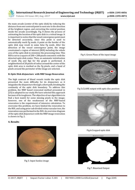 Optic Disk And Retinal Vesssel Segmentation In Fundus Images Pdf