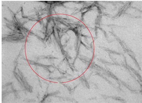 Transmission Electron Microscopy Tem Photo Of Cellulose Nanocrystals