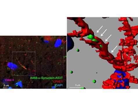 New Propagation Mode Of α Synuclein A Protein That Causes Parkinsons Disease Discovered By