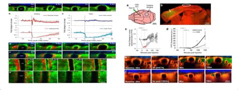 Cortical Spreading Depression Csd Closes Perivascular Spaces Pvs