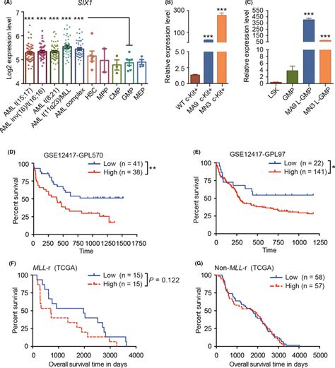 Six1 Expression Patterns And Its Correlation With The Acute Myeloid