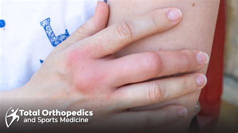 Where Does Sciatica Hurt Total Ortho Sports Medicine