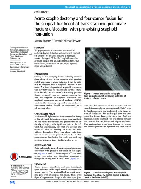 Pdf Acute Scaphoidectomy And Four Corner Fusion For The Surgical Treatment Of Trans Scaphoid