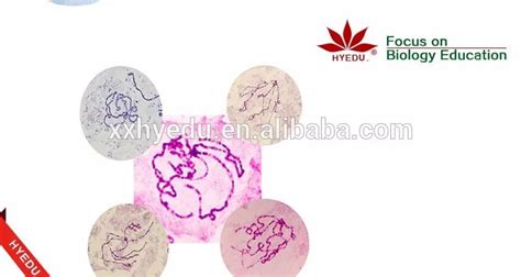 Fixed Set High Quality 14 Pieces Chromosome Microscope Prepared Slides