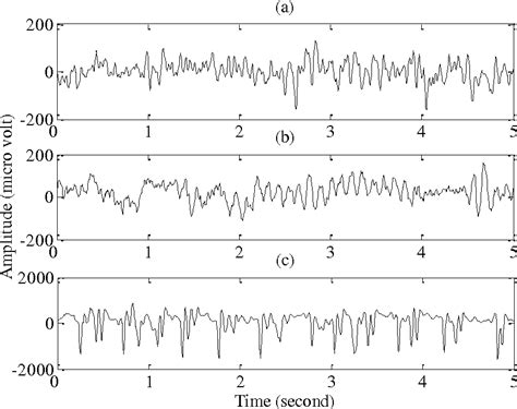 Figure 1 From Classification Of Eeg Signals For Detection Of Epileptic Seizures Based On