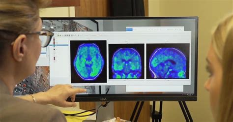 Health Beat Which Brain Games Improve Memory Health Beat