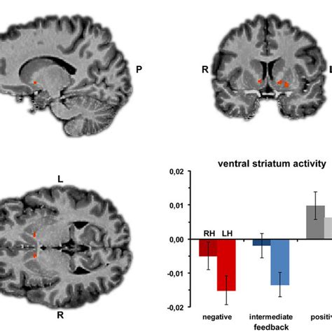 Increase In Brain Activity For Unexpected Positive And Negative Download Scientific Diagram