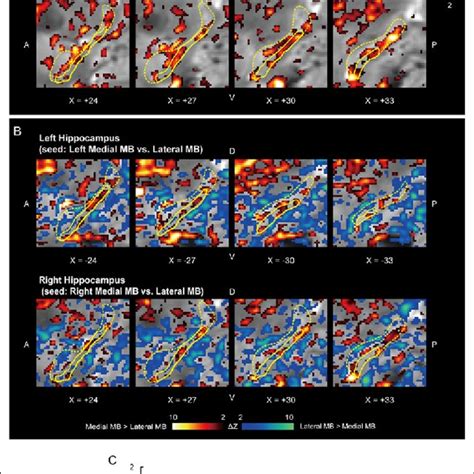 Functional Connectivity In The Subiculum A Voxel Wise Maps Of