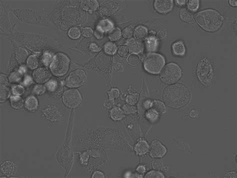 279 Questions With Answers In Turbidity Science Topic
