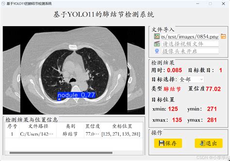 基于yolo11的肺结节检测系统 肺结节检测系统csdn csdn博客
