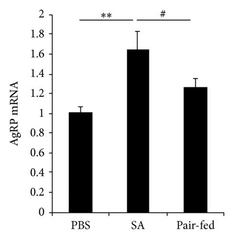 increase of agrp gene expression in hypothalamus of sa treated db db