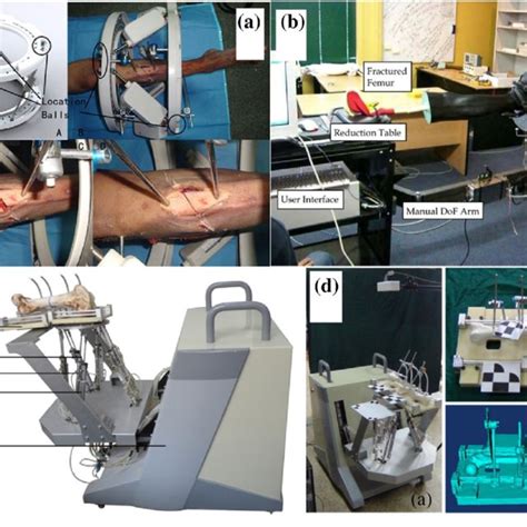 Pdf Evolution And Current Applications Of Robot Assisted Fracture