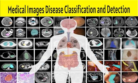 do medical image classification and detection in deep learning by adnan