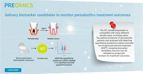 Biomarkers Proteomics Lcms Massspec Samplepreparation Ist… Preomics