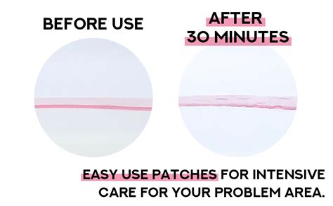 Amazon.com : misoli Retinol & Collagen Hydrogel Eye Patches : Beauty ...