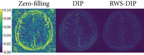 Comparison Of Reconstructions Of The Target Mr Image In Brain B Using Download Scientific