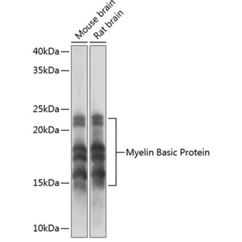 Anti Myelin Basic Protein Antibody [arc0535] A80785