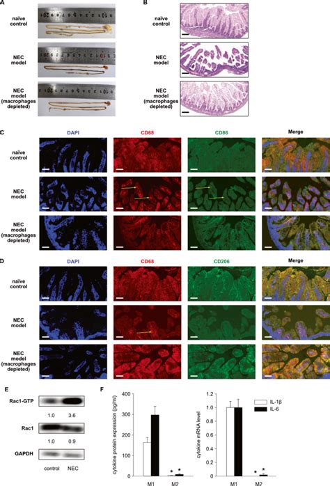 干扰新生儿单核细胞 巨噬细胞分化过程中的 Rac1 激活会影响 M1 巨噬细胞的炎症反应 Cell Death And Disease X Mol