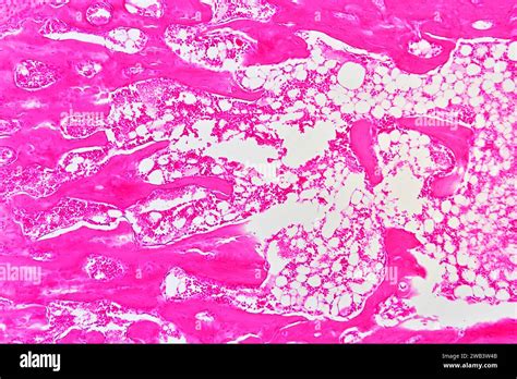 Human Red Bone Marrow Hematopoietic Tissue X75 At 10 Cm Wide Stock