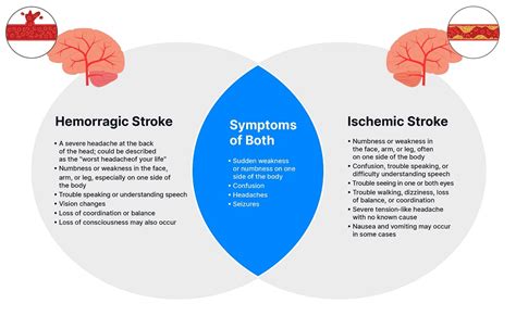Ischemic Stroke Vs Hemorrhagic Stroke
