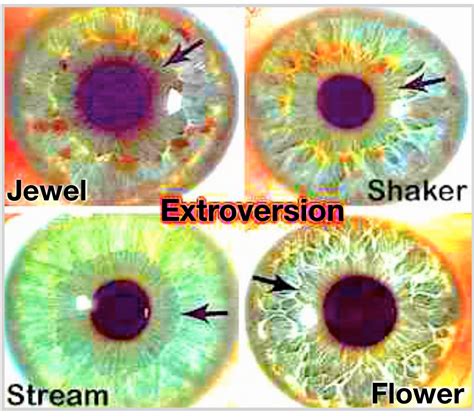 MBTI Introvert Vs Extrovert ANATOMY Part HEAL GROW For ACoAs