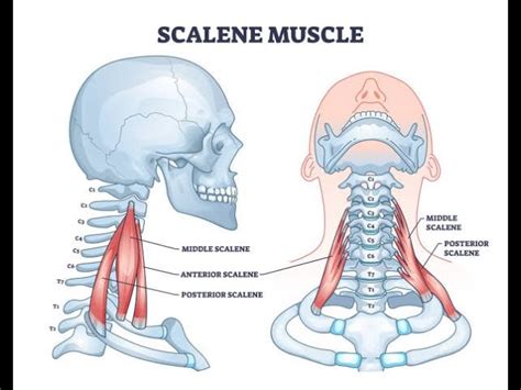 Posterior Scalene