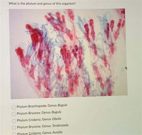Solved What Is The Phylum And Genus Of This Organismphylum