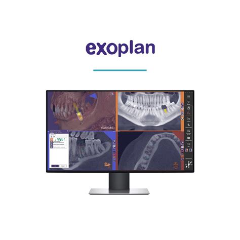 Exoplan Inspiring Excellence In Guided Surgery