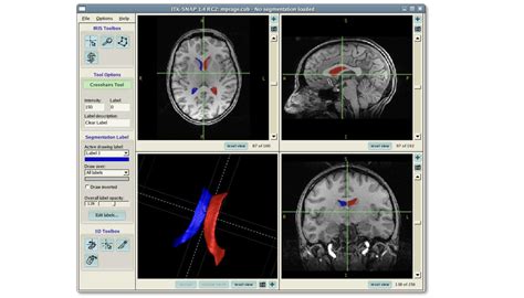Best Dicom Annotation Tools For Radiology Ai 2024 Review
