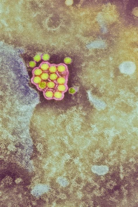 Yellow Fever Virus Particles Tem Photograph By Science Photo Library