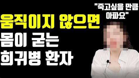 움직이지 않으면 몸이 굳는 희귀병을 앓는 여성 강직성 척추염 YouTube