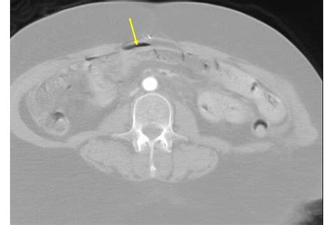 Triaging Polytrauma Slideshow