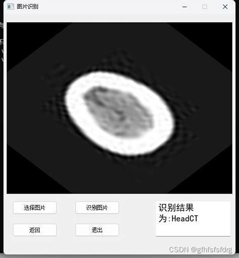 0073期通过cnn卷积网络识别ct图 含数据集cnn识别轮廓 Ct图像 Csdn博客 0073期通过cnn卷积网络识别ct图 含数据集cnn识别轮廓 Ct图像 Csdn博客