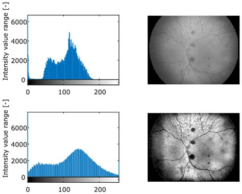 comparison of the original histogram top and application of the clahe
