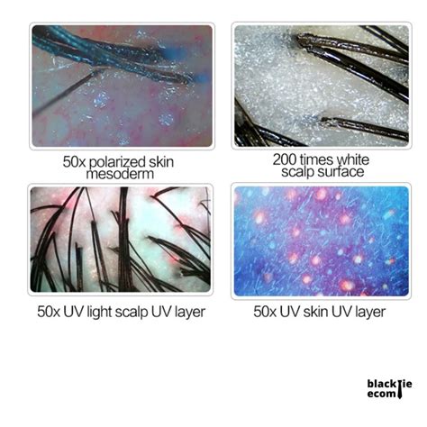 Bkt3849 Hd Portable Skin Detector Scalp Detector Magnifying Glass Professional Hair Follicle