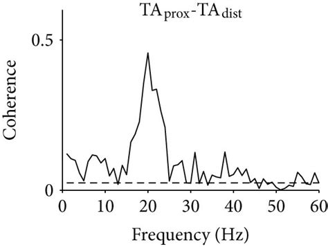 Raw Eeg And Emg Traces Autospectra And Coherence Results From A