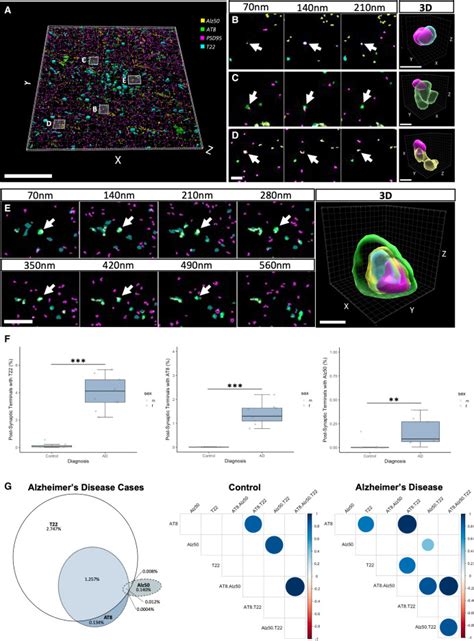 Synaptic Oligomeric Tau In Alzheimers Disease — A Potential Culprit In