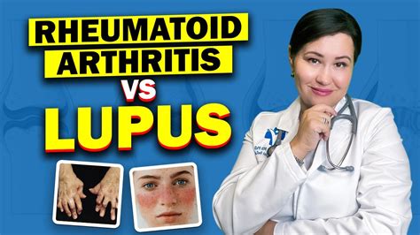 Rheumatoid Arthritis And Lupus At The Same Time Youtube