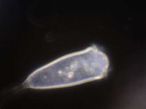 Nemotode Free Swimming Ciliates And Flagellates Plum Creek Water