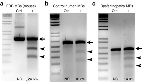 Mstn Talens Mediated Gene Editing In Primary Human And Mouse Myoblasts Download Scientific