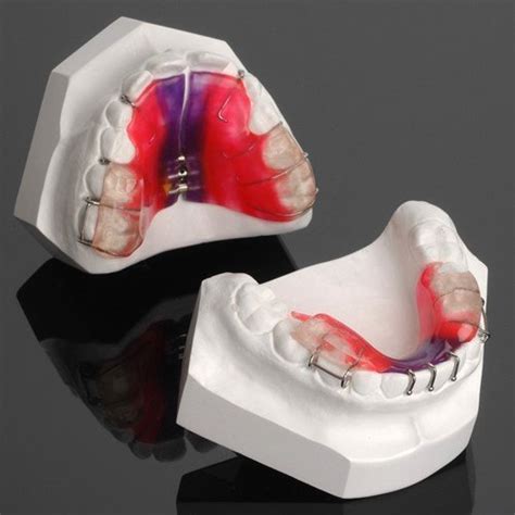 Ortho Twin Block At Best Price In Madurai By Smile Stones Dental Pvt