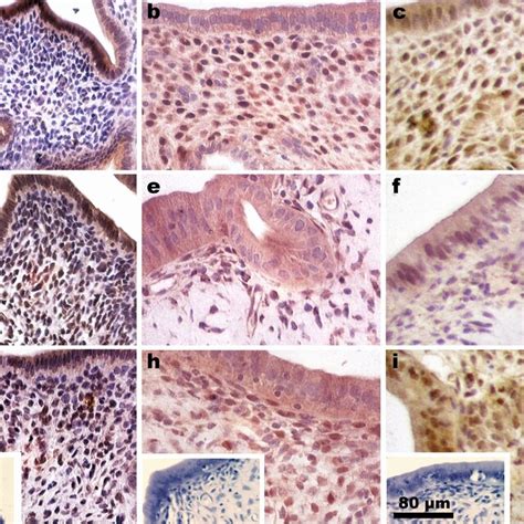 Endometrial Layer Of Control Ac Testosterone Df And Dht Gi Download Scientific